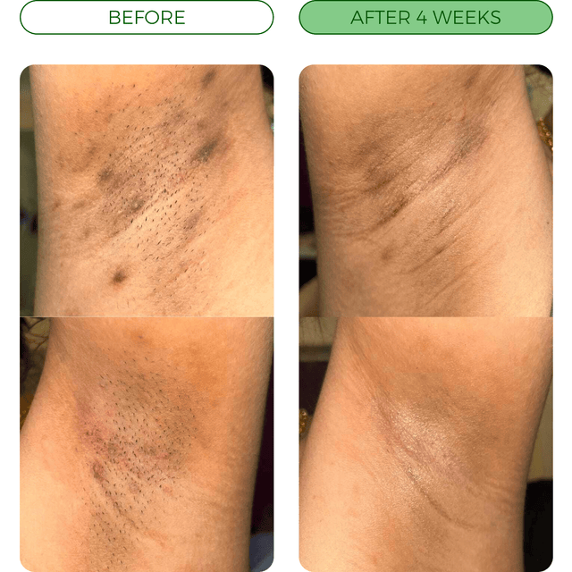 Turmeric Glow Soap – Earthly Derm