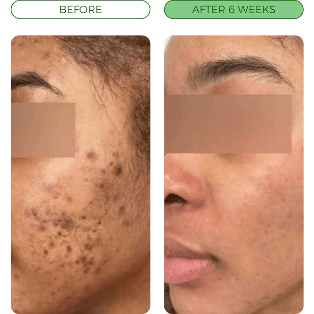 Turmeric Glow Soap – Earthly Derm