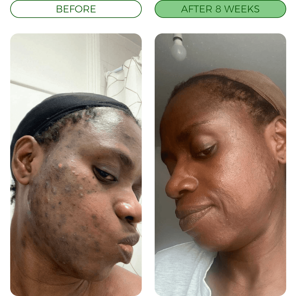 Turmeric Glow Soap – Earthly Derm